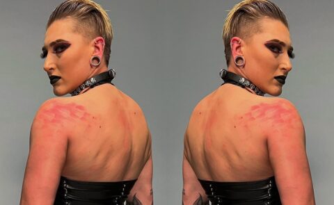Photos: Rhea Ripley Suffered Wardrobe Malfunction On WWE Raw; Showed Injury Scars